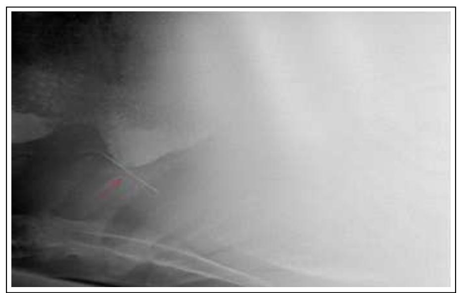 ‘ig 6: lateral radiograph of abdomen in murrah buffalo