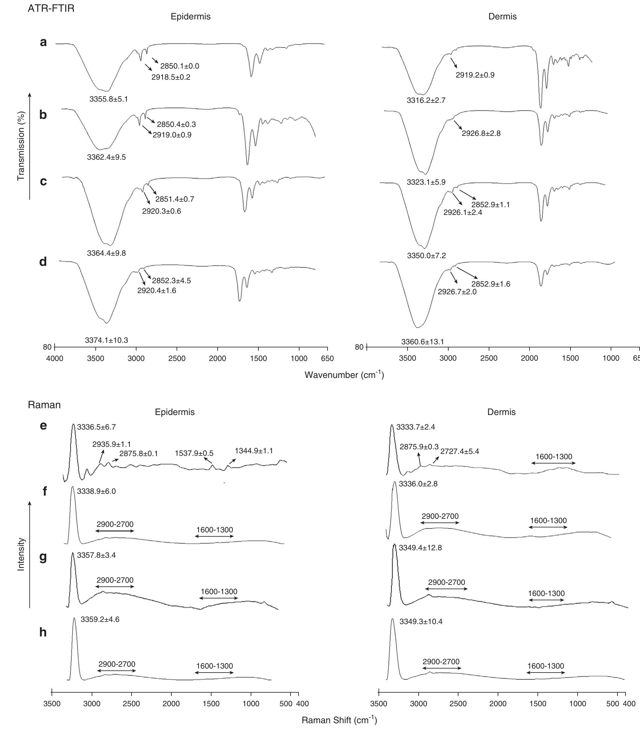 Atr-ftir and raman spectra of epidermis and dermis. (a—d)