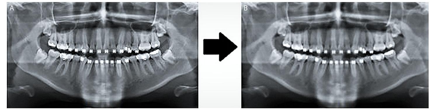Example of filtering images using imagej's gaussian filter.