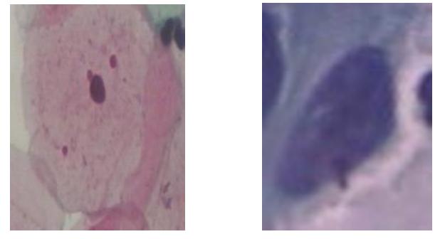 Normal and abnormal pap smear cervical cell images