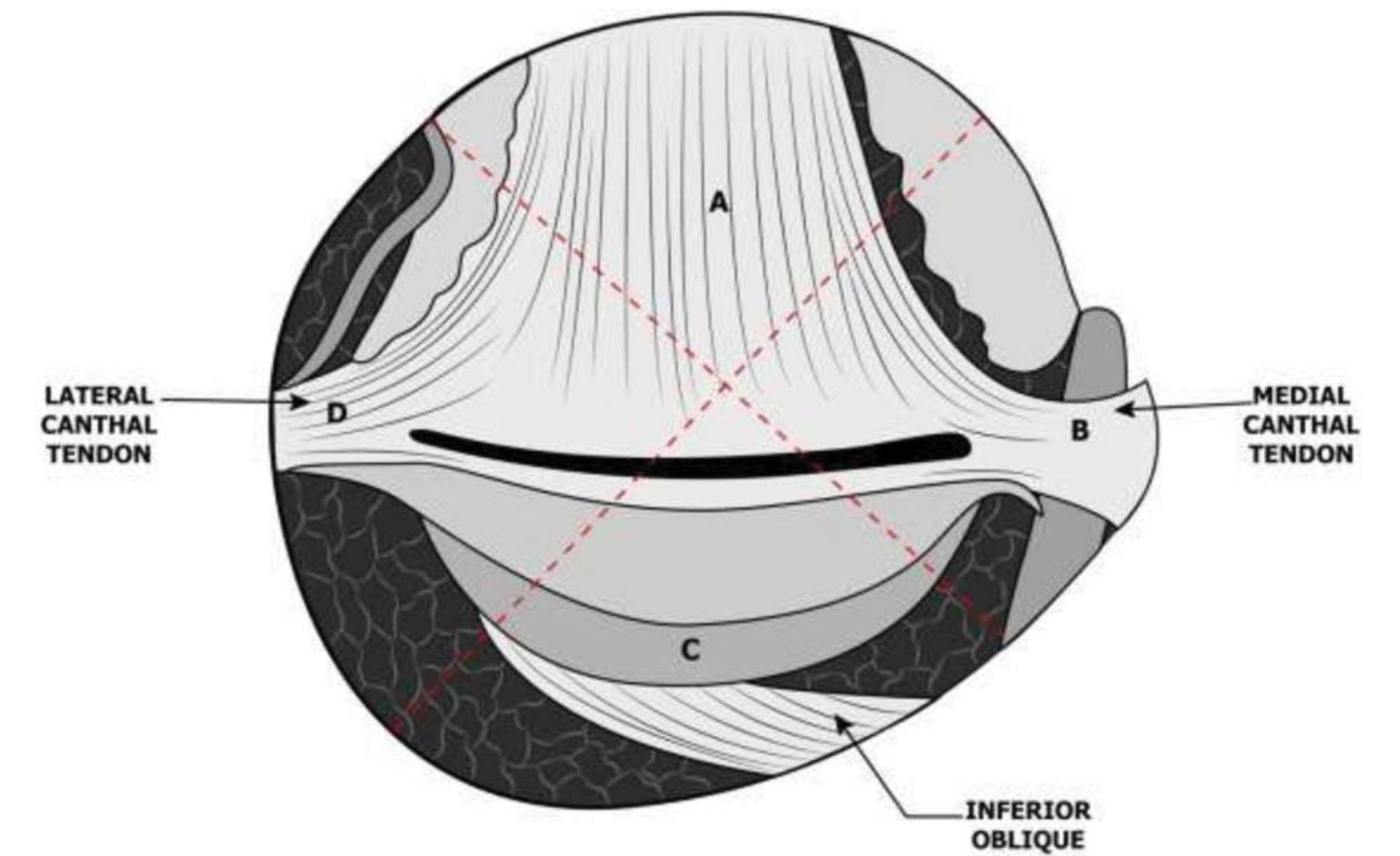 The diagram illustrates the four access quadrants of the