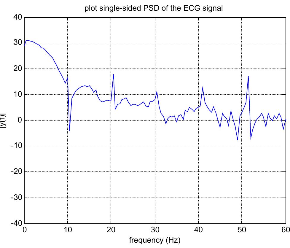 Power spectrum of extracted fetal ecg signal