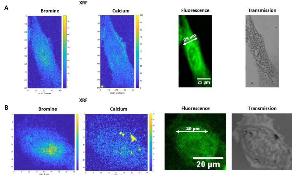 X-ray fluorescence maps of bromine and calcium normalized to