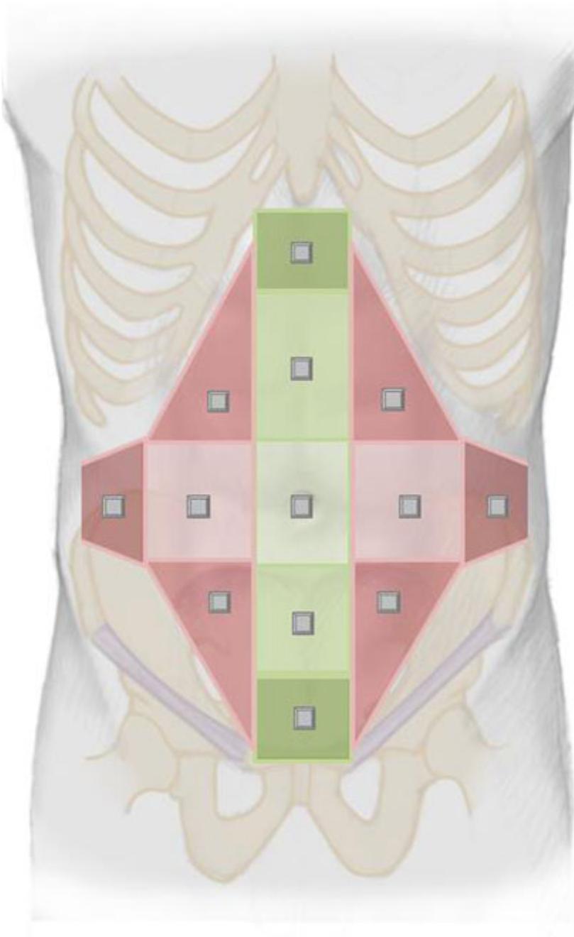 Eurahs ventral hernia model for registration and classifica-