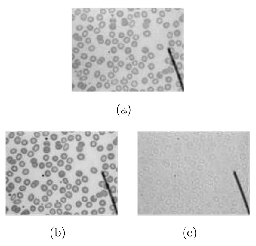 Figure 3 - Red Blood Cell Segmentation with Overlapping Cell