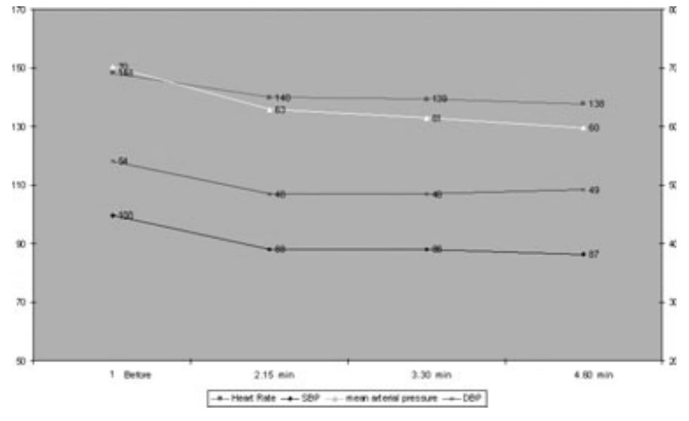 Physiologic parameters before and 15, 30, and 60 min after