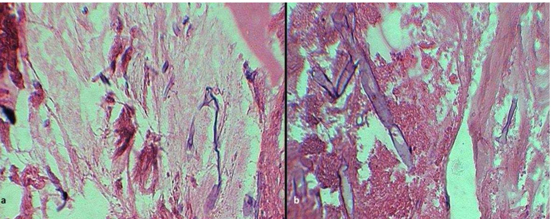 The hematoxylin and eosin stained histopathological