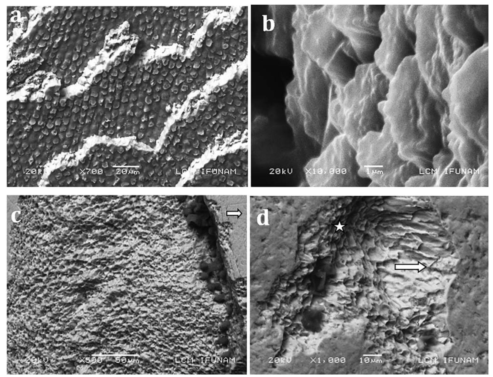 Sem images showing different types of enamel loss: (a) loss