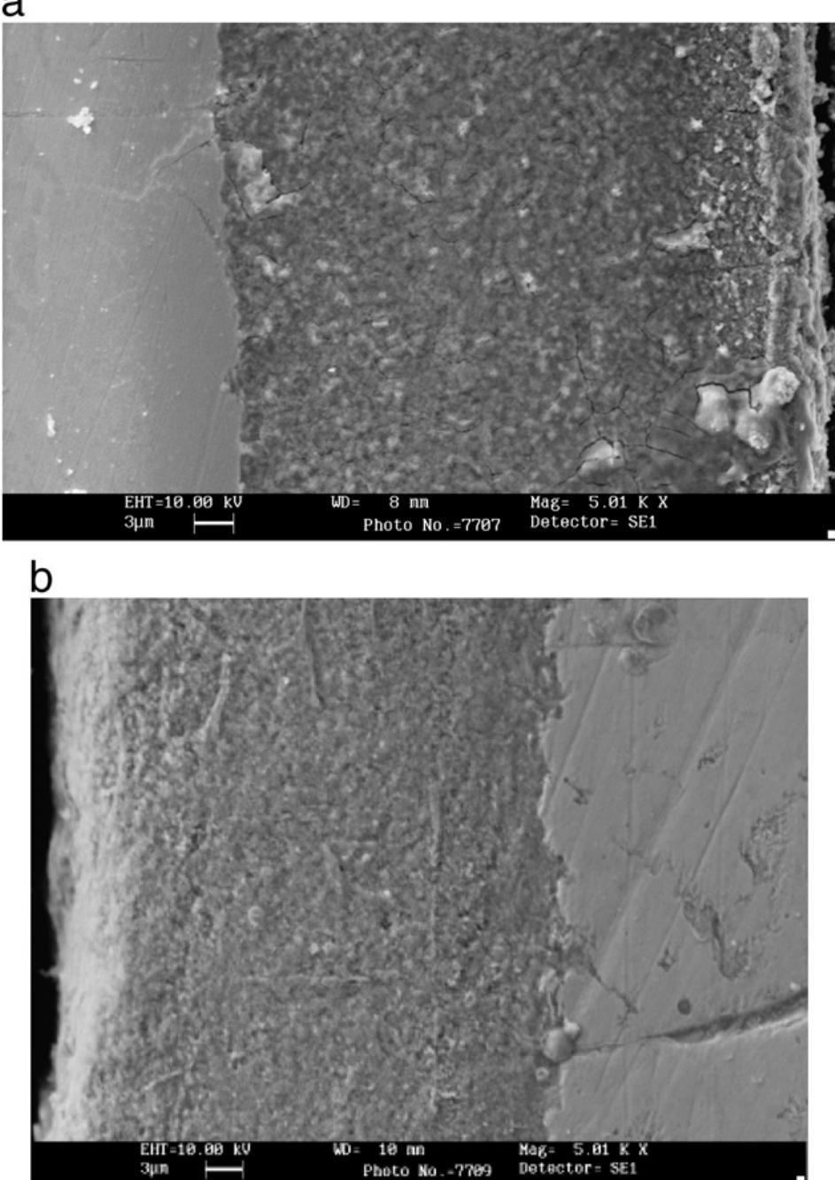 Microstructure of the cross-section of (a) the parent and