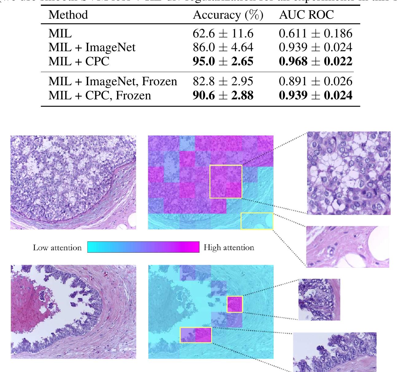 Attention map visualization examples for key instance