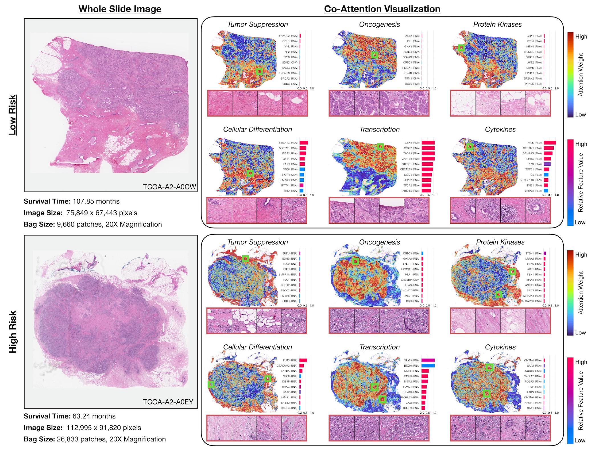(PDF) Multimodal Co-Attention Transformer for Survival Prediction in Gigapixel Whole Slide Images
