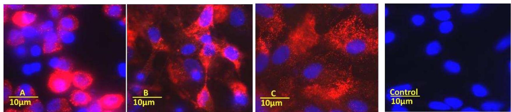 14 immunolocalization of cyp19a (red colour) in cultured