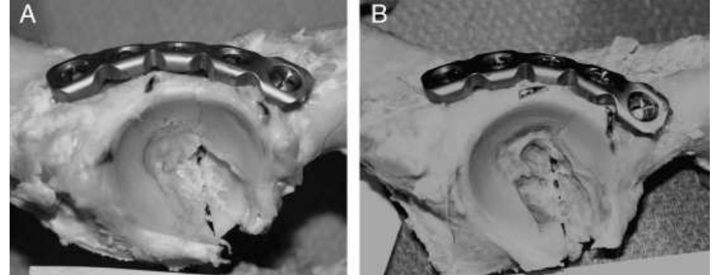 Photograph of canine acetabular osteotomies repaired with
