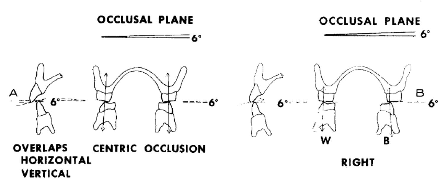 (PDF) Occlusal Concepts in Complete Denture Prosthodontics: A ...