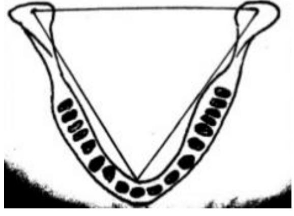 (PDF) Archform in Orthodontics: A Review