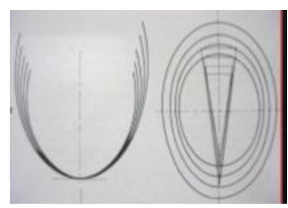(PDF) Archform in Orthodontics: A Review
