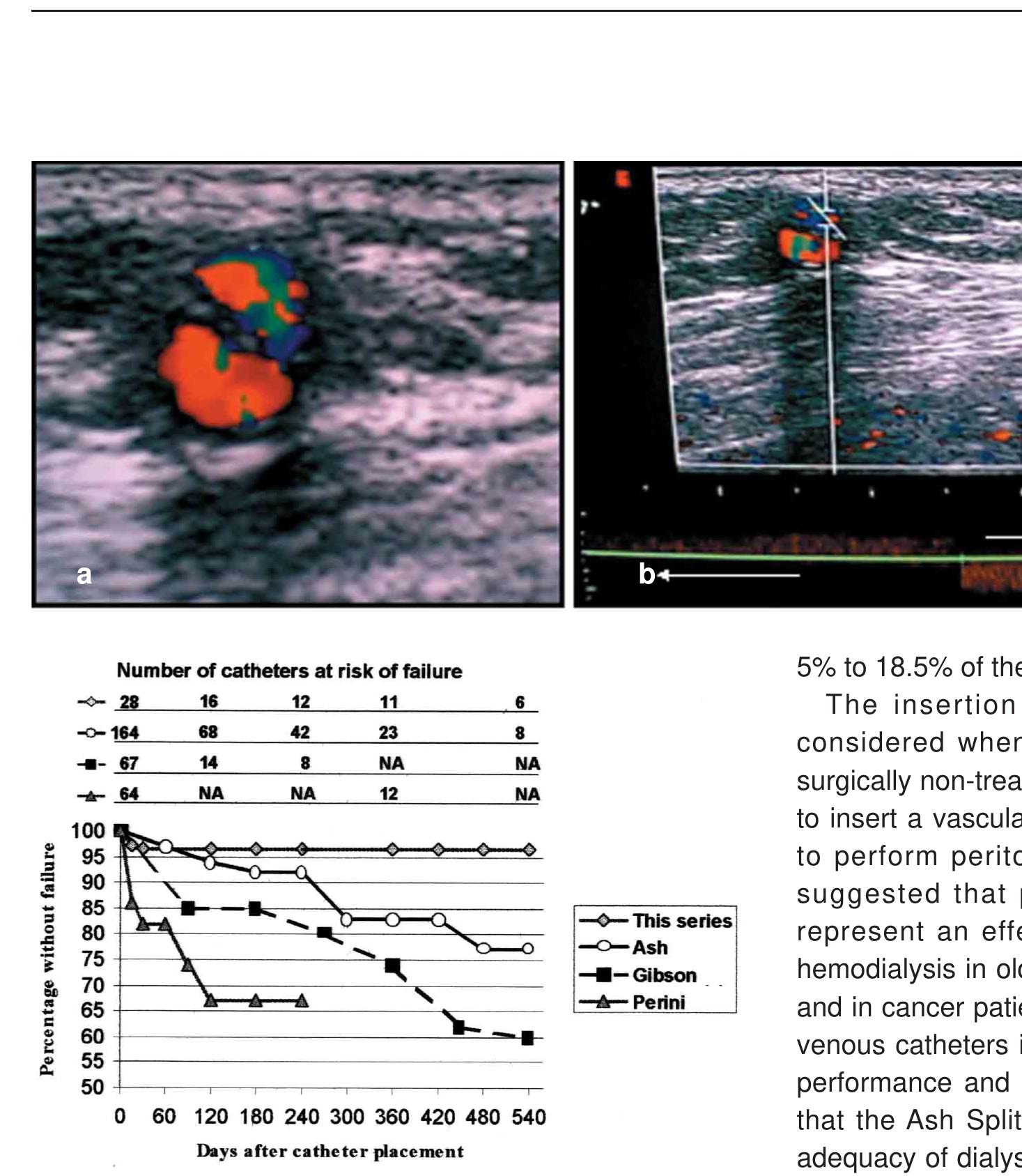(PDF) Placement, Performance and Complications of the Ash Split Cath ...