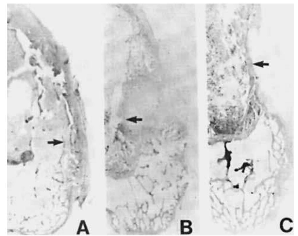 Histologic analysis showed living adipose cells. as the