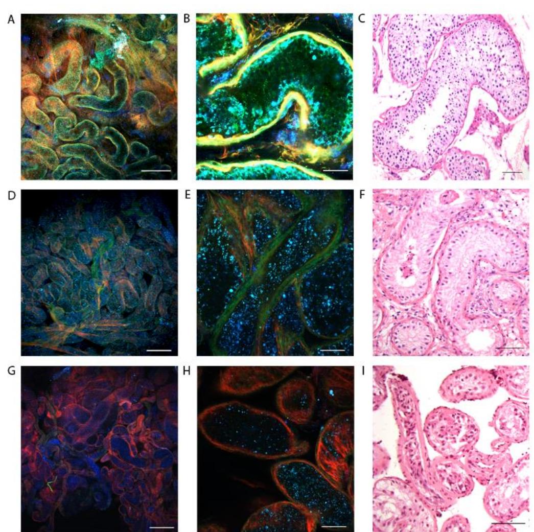Different seminiferous tubular histology patterns imaged