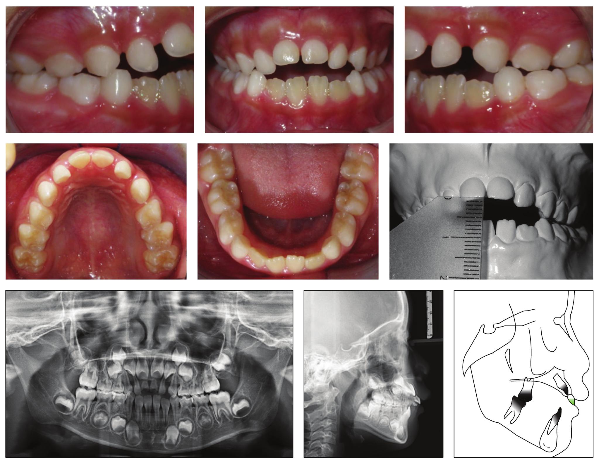 Ficure i: pretreatment intraoral photographs, radiographs,