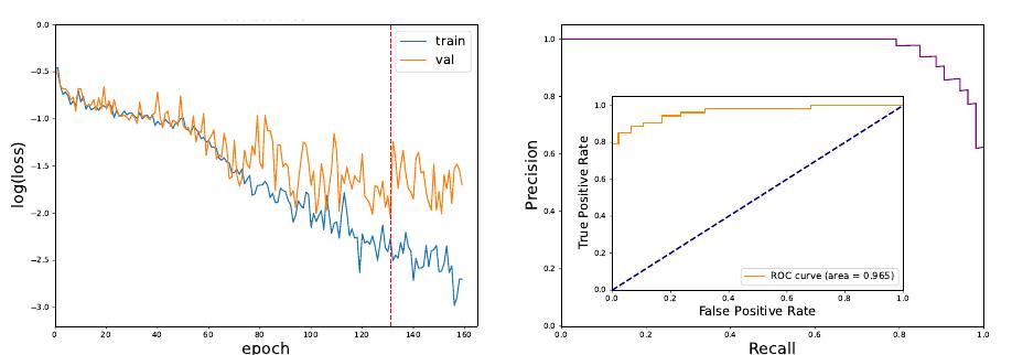 A) lstm loss curves for train and validation sets b)