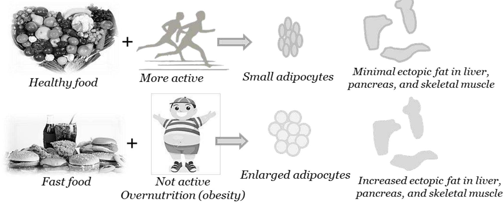 Illustration of adipose tissue and organ steatosis