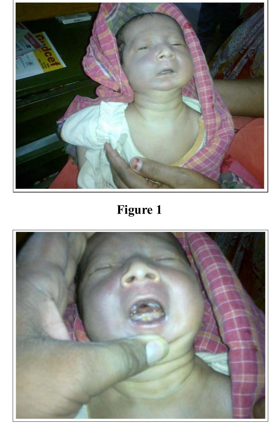 Intubation, mechanical ventilation, and tracheostomy can be