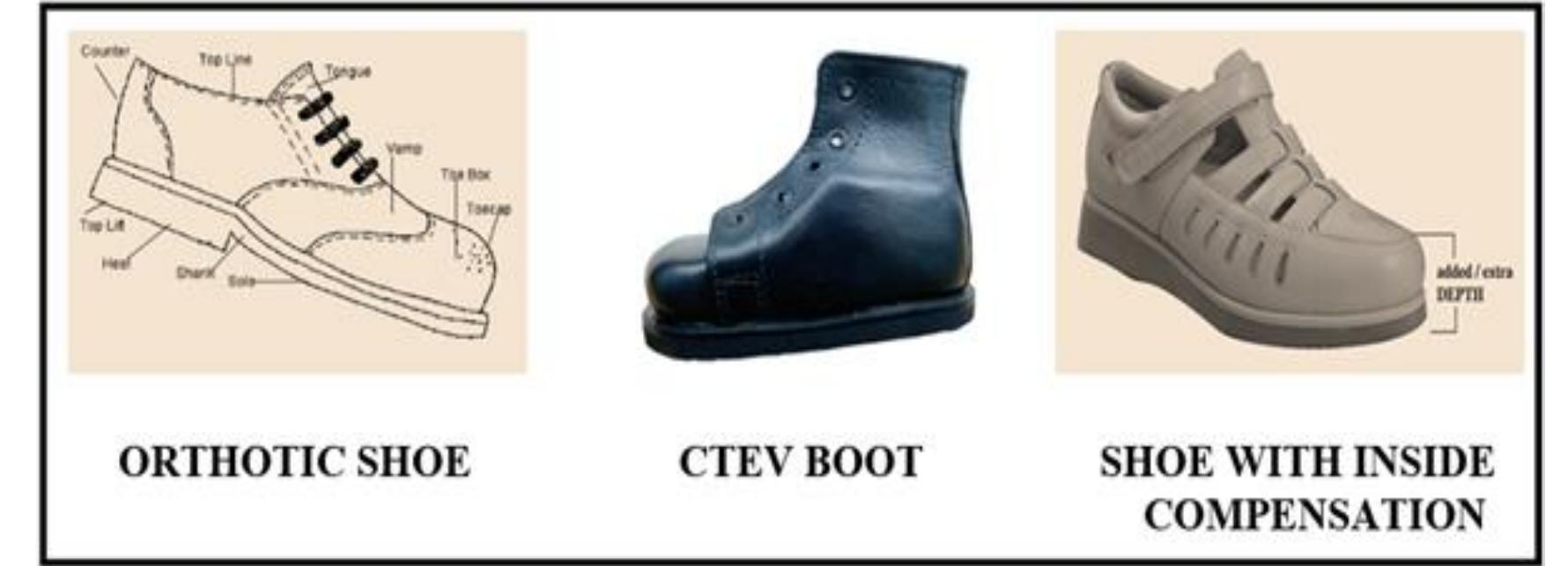 Upper and lower parts of the shoe. th shoes: are the vital