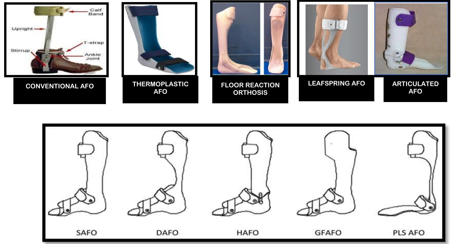 Varus or valgus at the ankle). different types of plastic