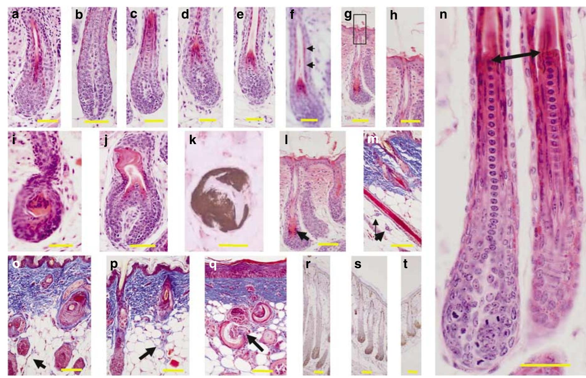 Progressive histologic lesions in hr mice; scale bar in each