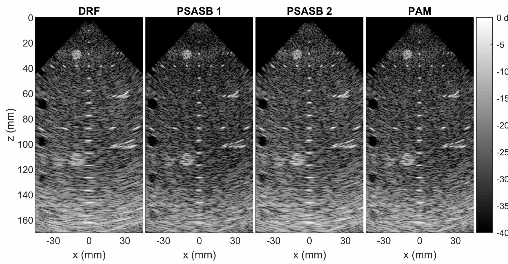 Figure 7 - Two-Stage Beamforming for Phased Array Imaging