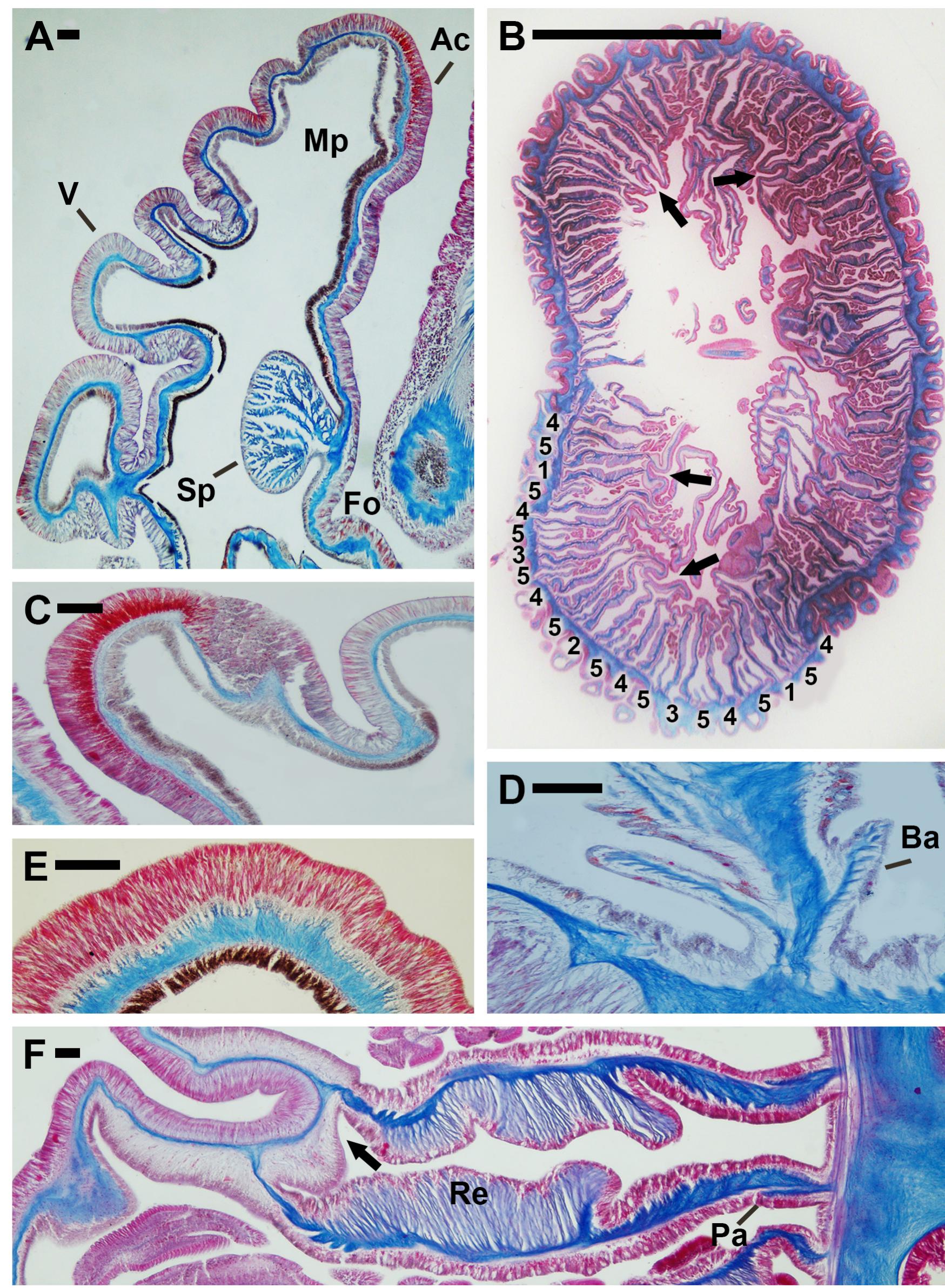 Internal anatomy of bunodosoma californicum carlgren, 1951.
