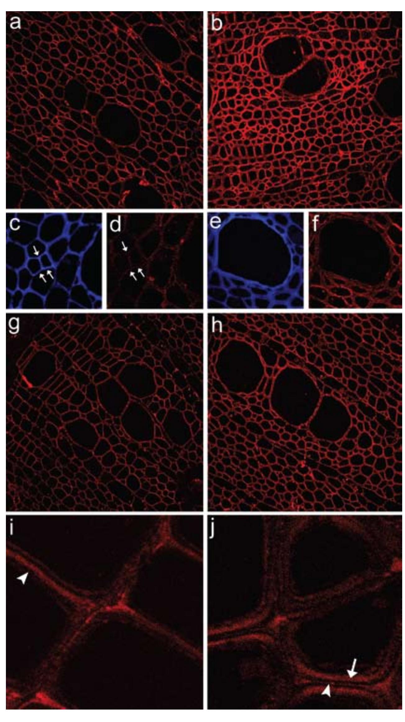 Figure 3 - Xylem Anatomy and Cell Wall Ultrastructure of
