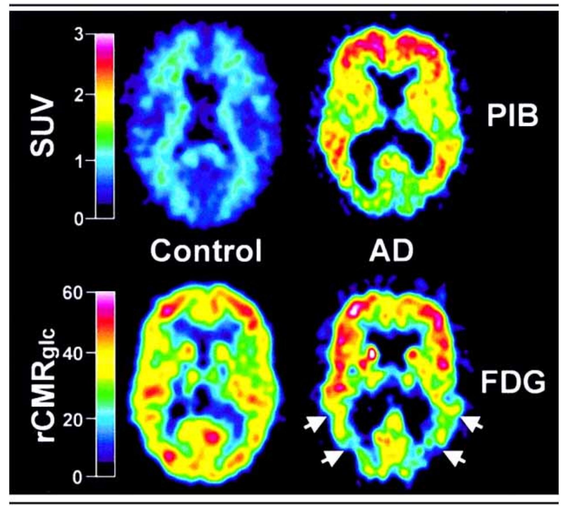 Figure 16 - from Radioligand Development for PET Imaging of