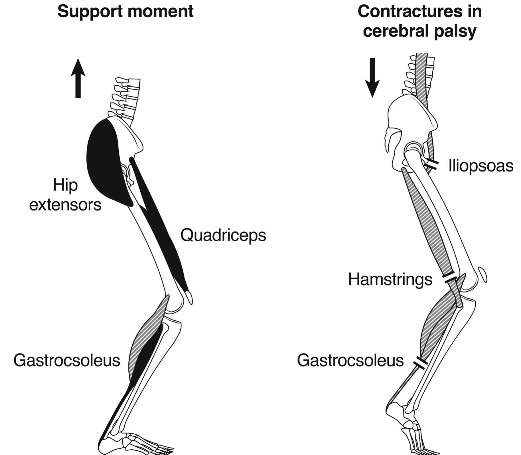 The sagittal plane motors for the lower limb. of the three