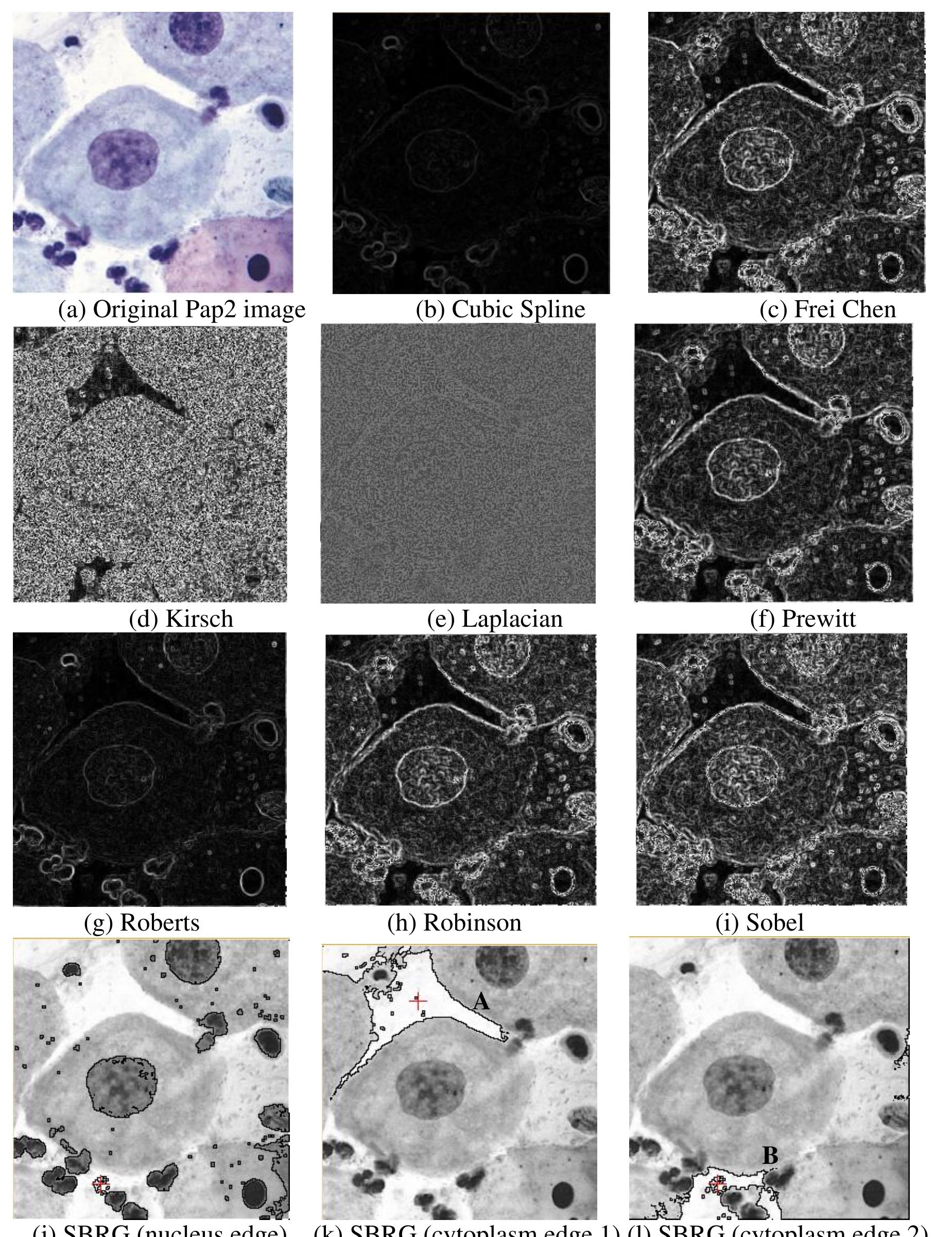 Automated edge detection technique for pap smear images