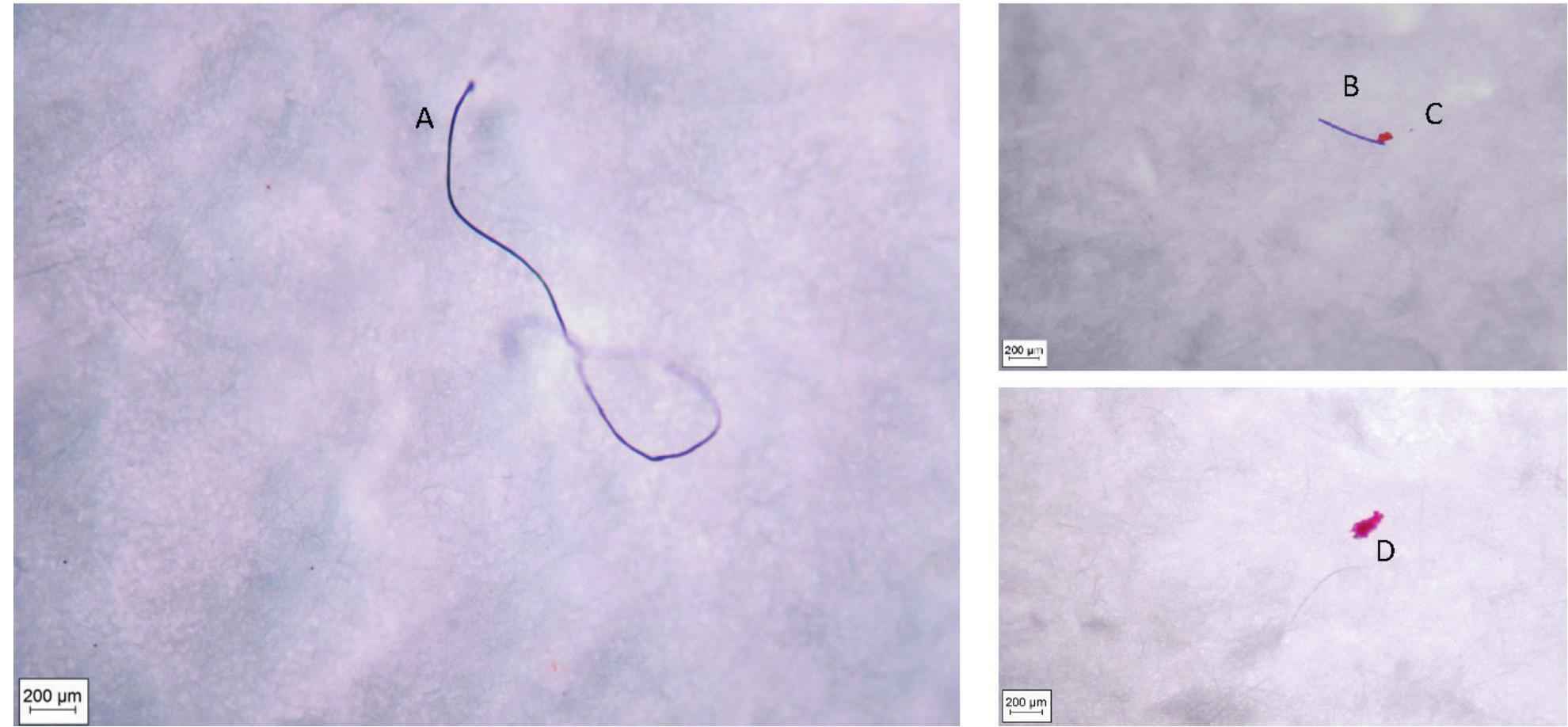 Optical microscopy images of microplastic particles in