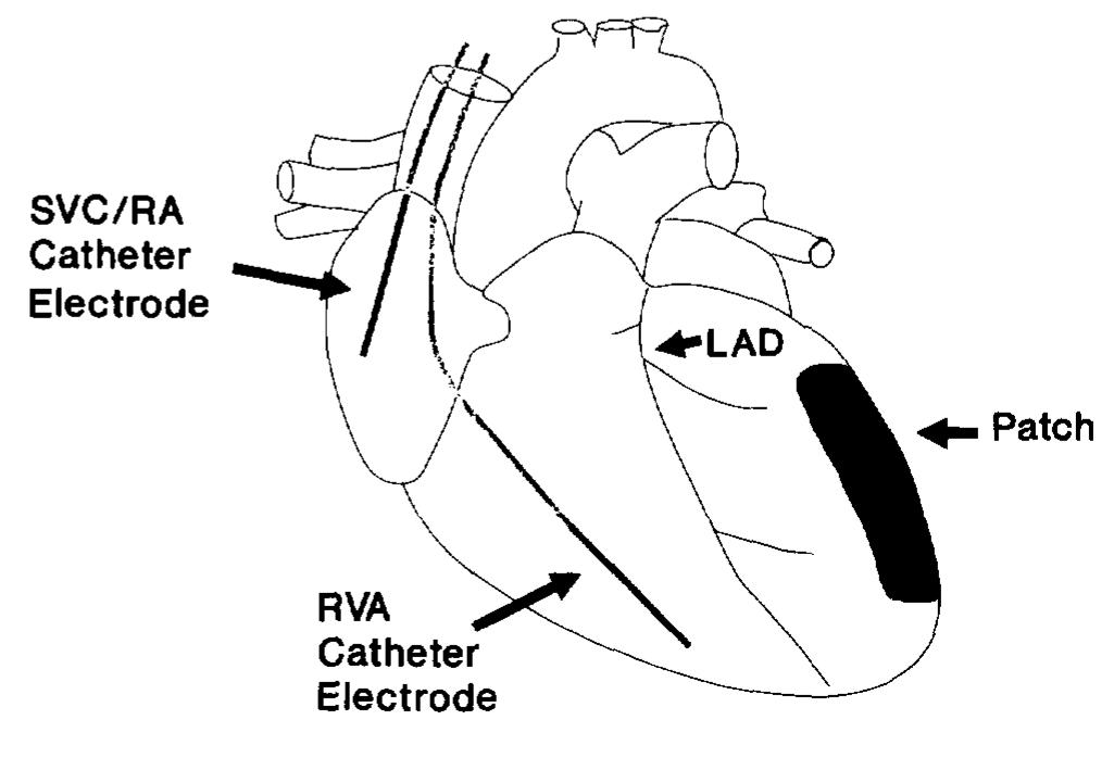 Schematic representation of the electrode distribution. one