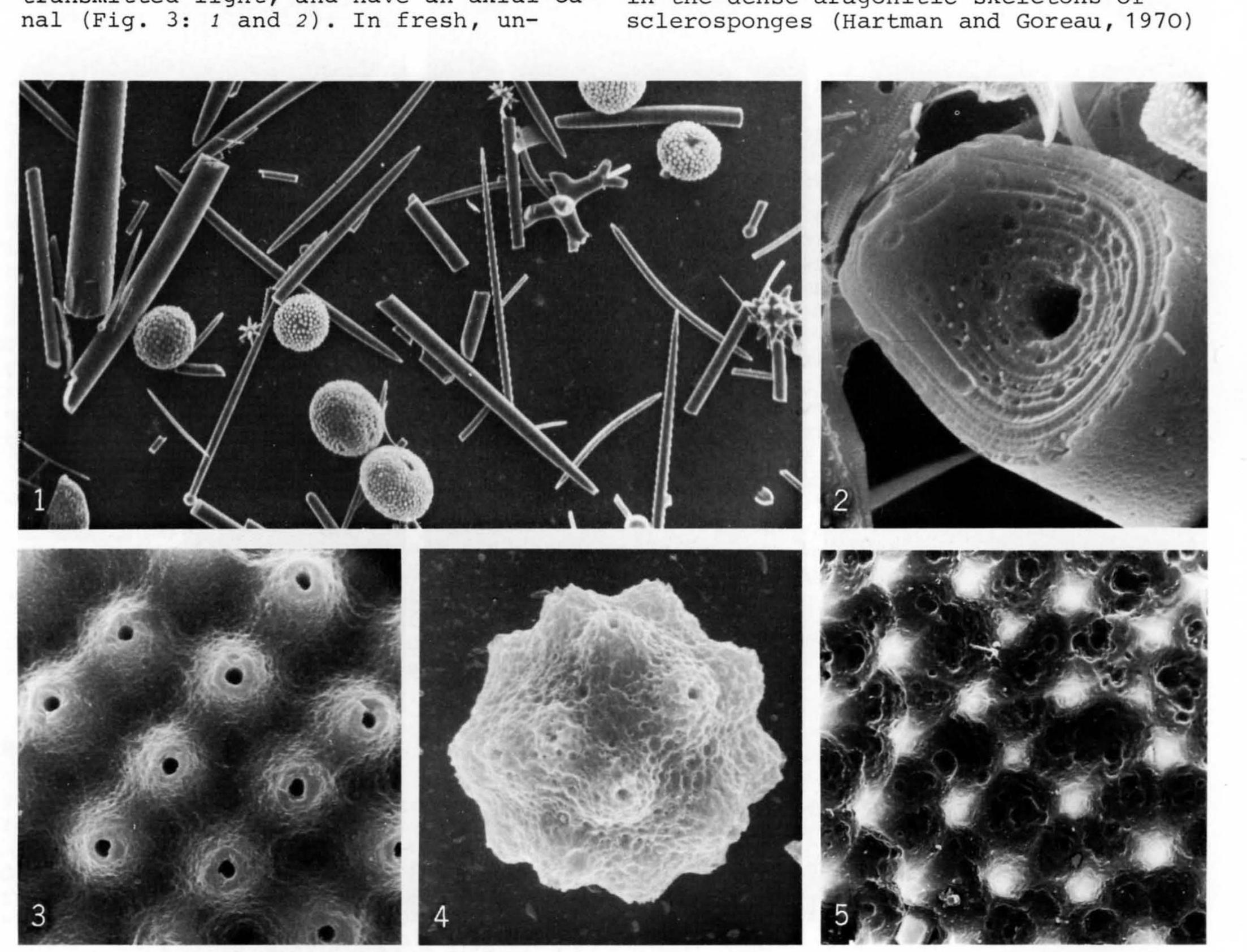 Sponge spicules in reef sediments. 1: typical acid-insoluble