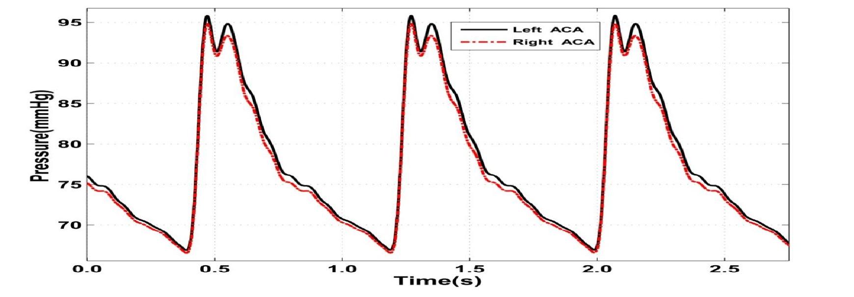 The pressure-time graph of left and right anterior cerebral