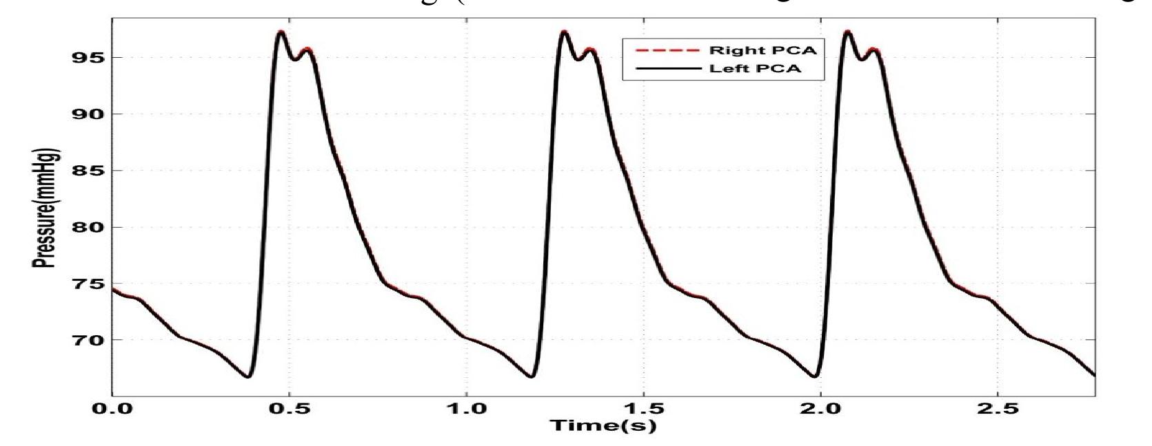 Pressure-time graph of left and right posterior cerebral