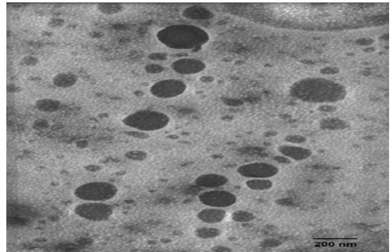 Morphology of the nanoparticle f1 using tem nanoparticle