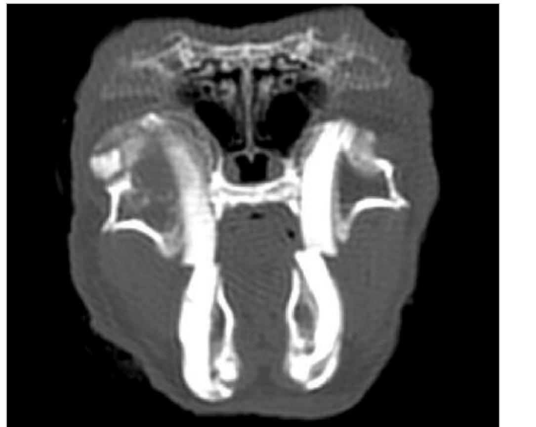 Periapical changes, apical bone penetration, and abnormal