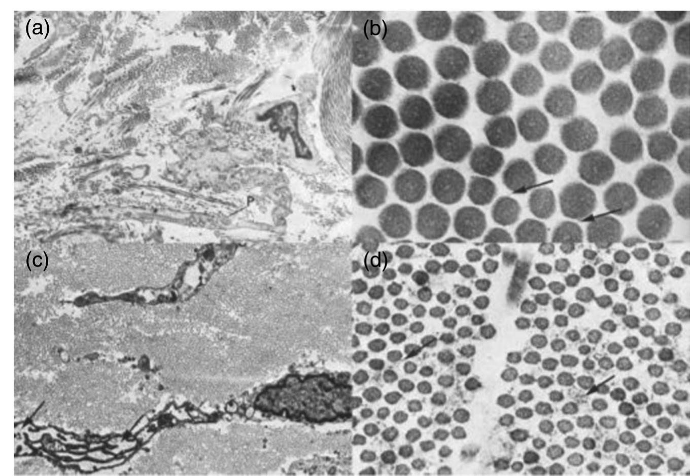 Area of reticular dermis showing (a) the collagen fibrils in