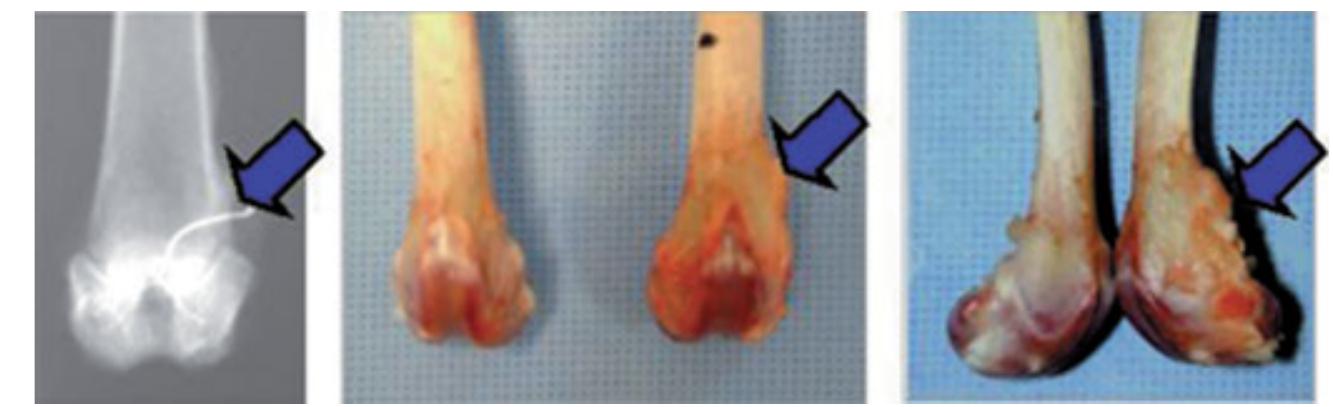 Photographs and radiograph of the femur. the radiograph of