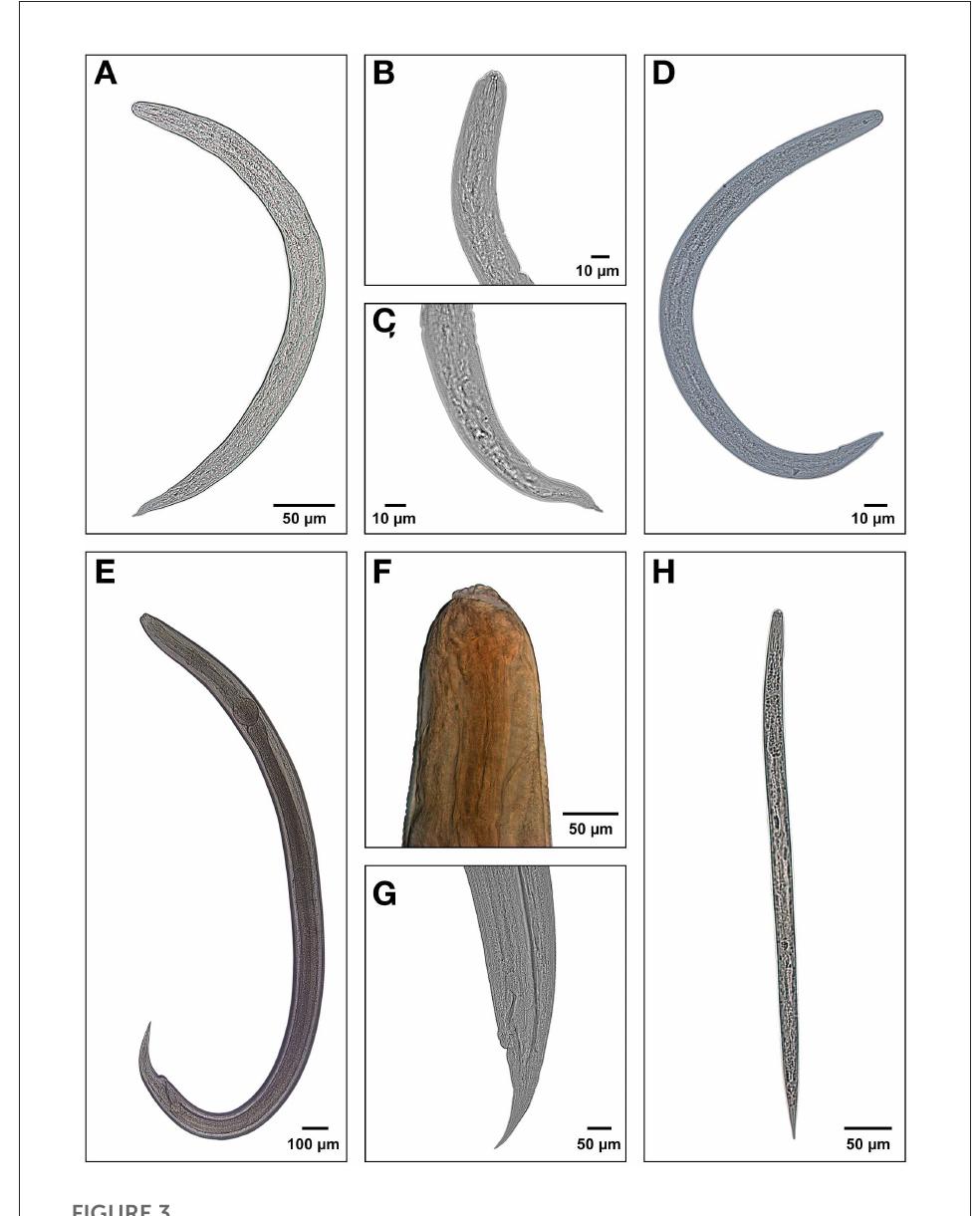Larval forms of the nematodes recuperated from the mollusks