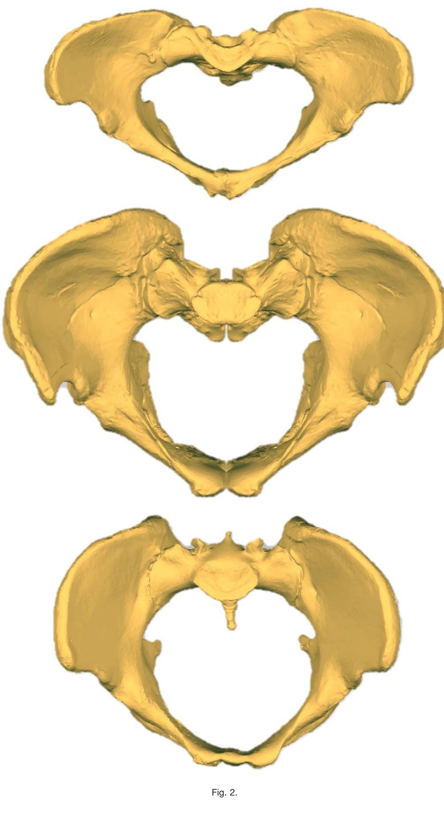 Figure 3 Evolution Of The Human Pelvis