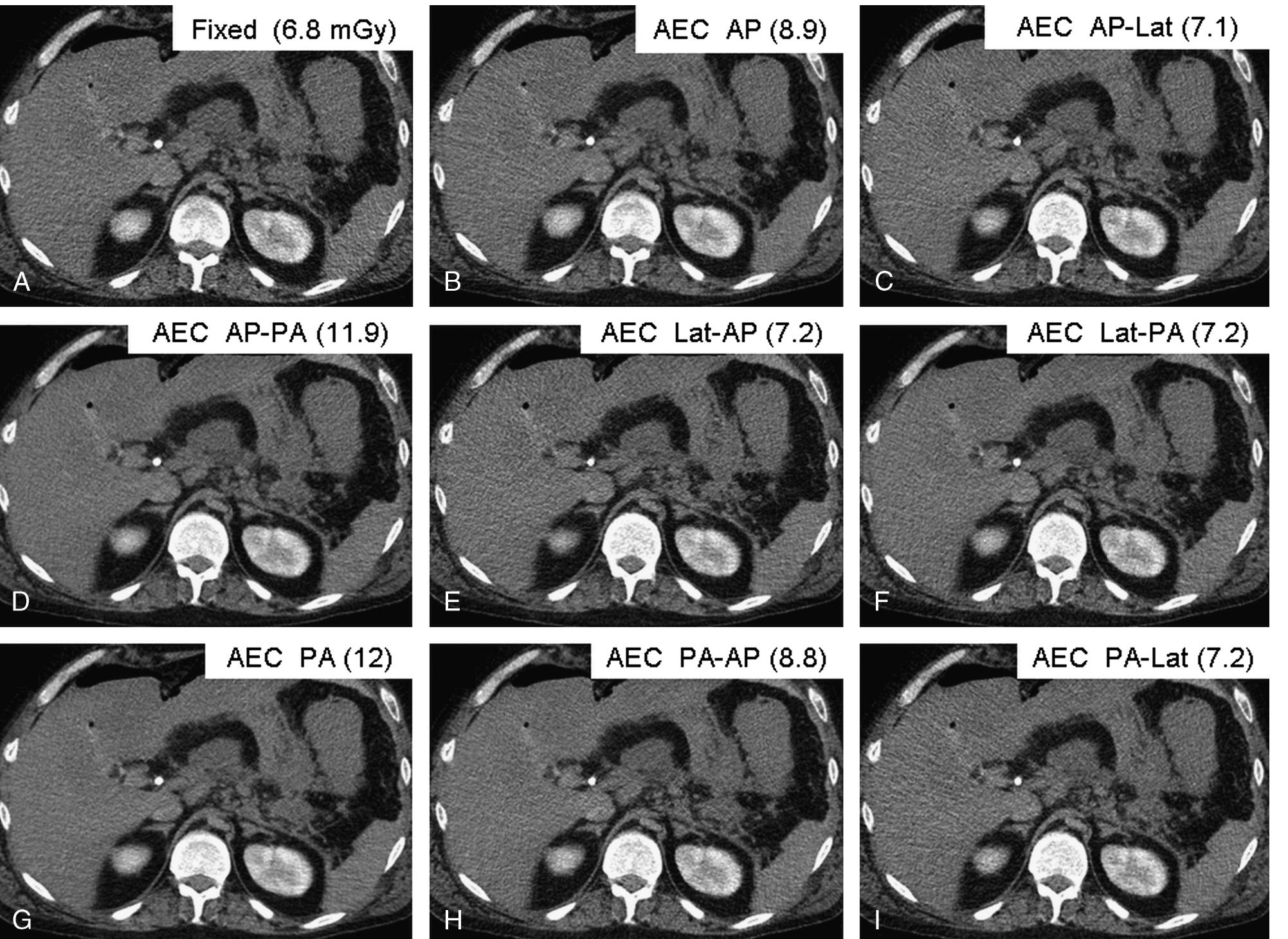 Figure 1 - from Effect of Localizer Radiograph on Radiation