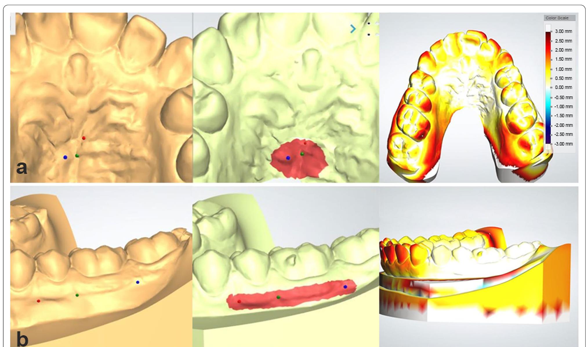 Registration of a maxillary models, b mandibular models with