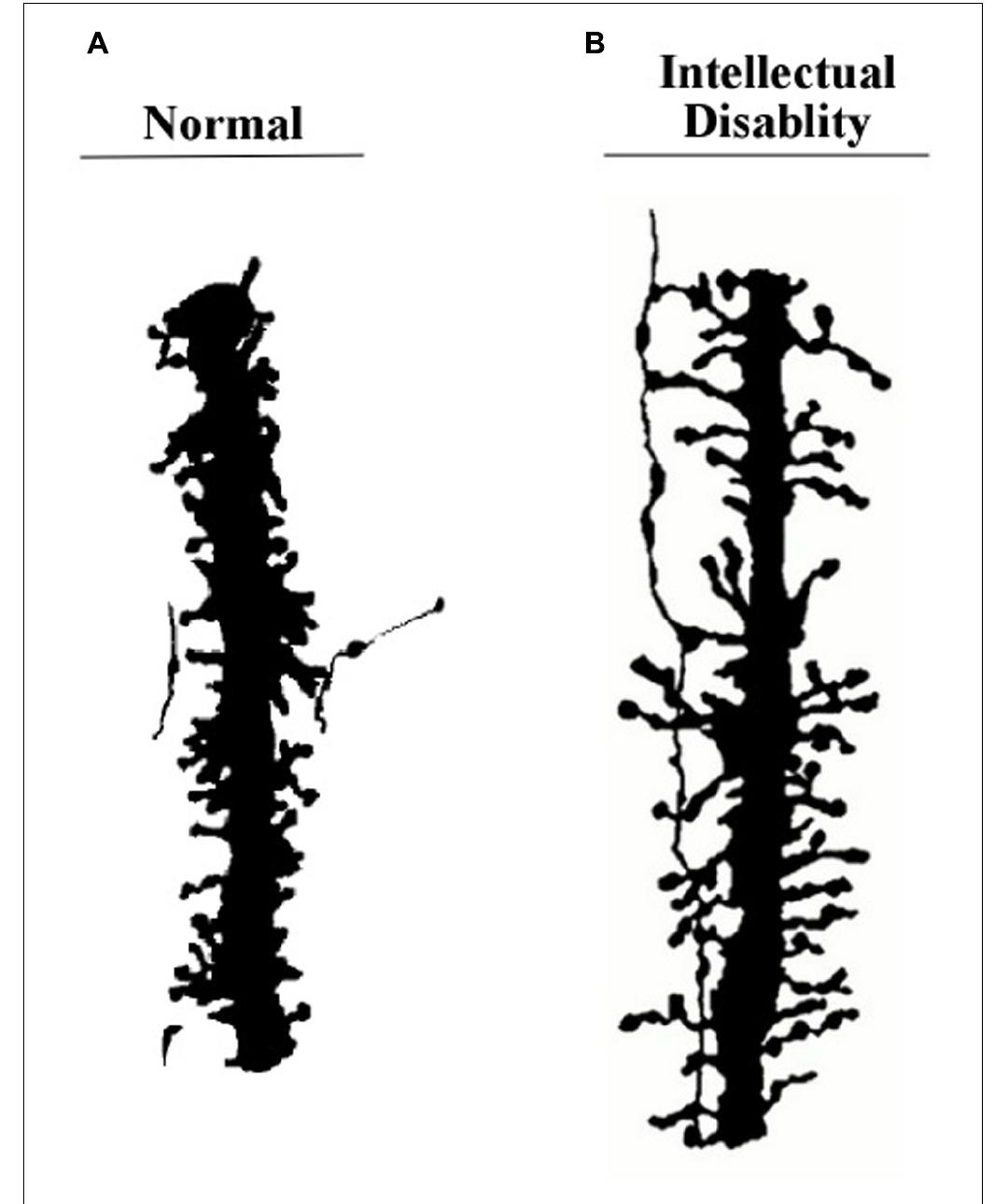 | segments of apical dendrites of the newborn human infants.